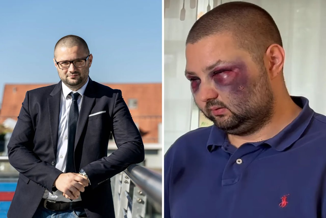 Bayern: AfD-Landtagskandidat Andreas Jurca krankenhausreif geprügelt ...
